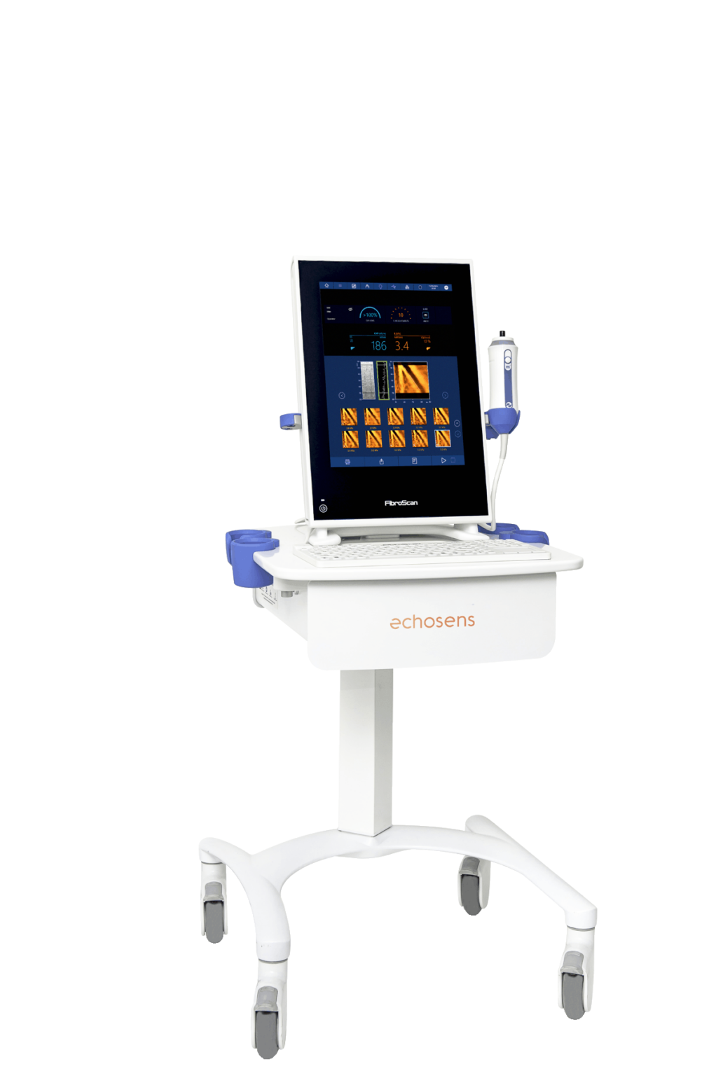 FibroScan Service in Hong Kong - HKAI